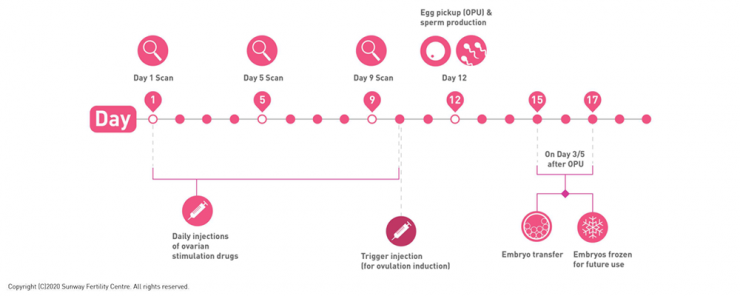 IVF Treatment & Cost Malaysia | Sunway Fertility Centre