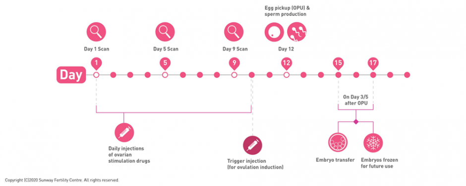 IVF Treatment & Cost Malaysia | Sunway Fertility Centre